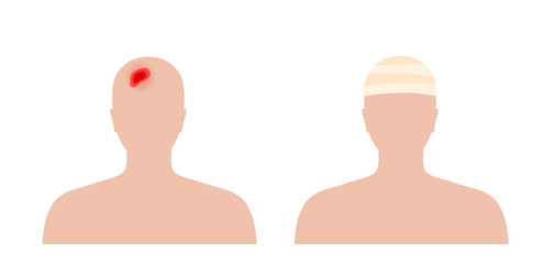 Human head trauma Royalty Free Vector Image - VectorStock