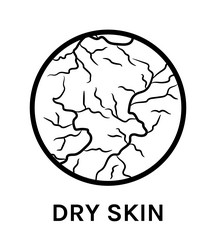 Skin Dryness Vector Images (94)
