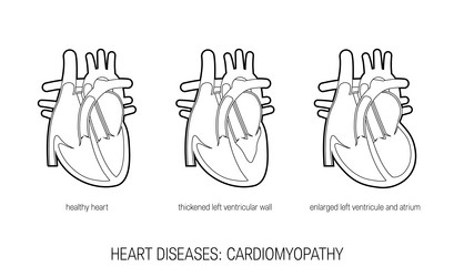 Internal Diseases Vector Images (over 26,000)