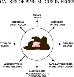 Mucus Vector Images (over 2,000)