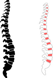 Diagram of a human spine in front and side Vector Image