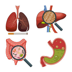 Anatomy of human organs with various diseases Vector Image