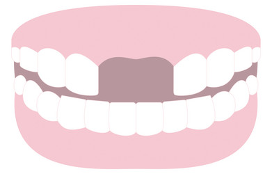 Missing Teeth Vector Images (over 190)