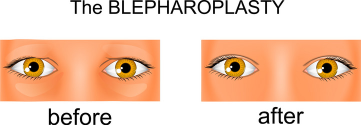 Eyelids Vector Images (over 4,400)