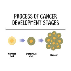 Process of cancer development stages isolated Vector Image