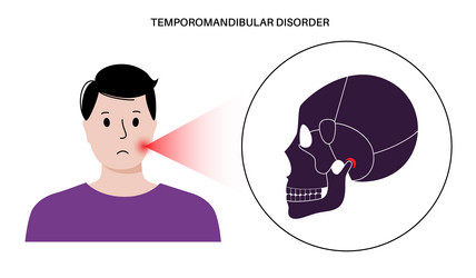 Tmd tmj disorder Royalty Free Vector Image - VectorStock