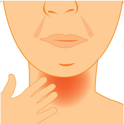 Throat pain woman Royalty Free Vector Image - VectorStock