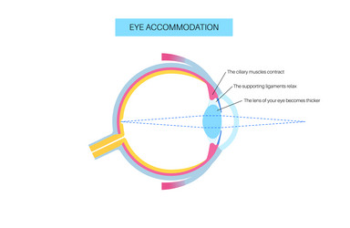 Eye accommodation poster Royalty Free Vector Image