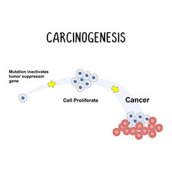 Process of cancer development stages isolated on Vector Image