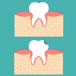 Tooth anatomy Royalty Free Vector Image - VectorStock
