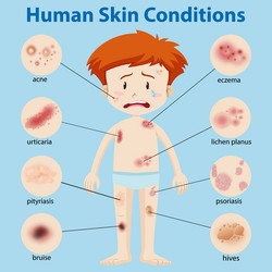 Diagram showing different human skin conditions Vector Image