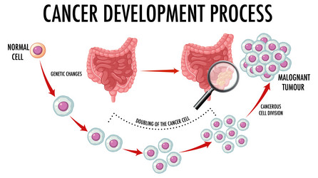 Diagram showing cancer development process Vector Image