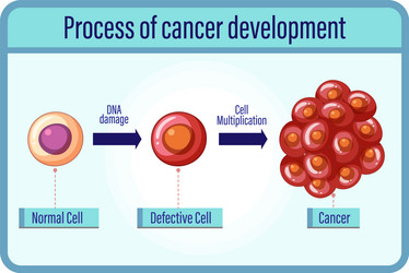 Process of cancer cell development Royalty Free Vector Image