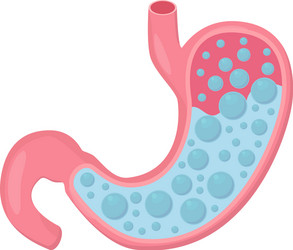 Human stomach gastroesophageal reflux disease Vector Image