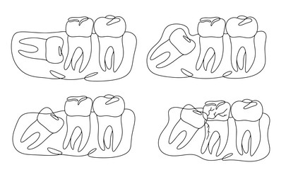 Impacted Teeth Vector Images (over 230)
