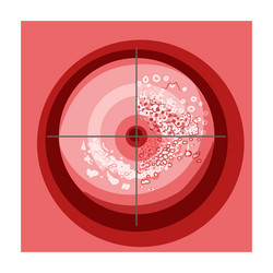 Pap Smear Vector Images (over 100)