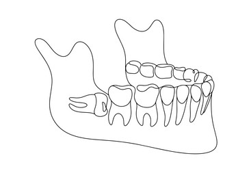 Wisdom tooth impacted teeth one line Royalty Free Vector