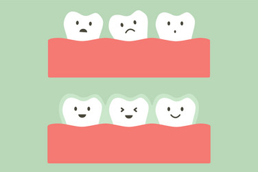 Whitening tooth realistic teeth before and after Vector Image