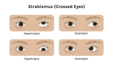 Realistic human eyes with pupula duplex Royalty Free Vector