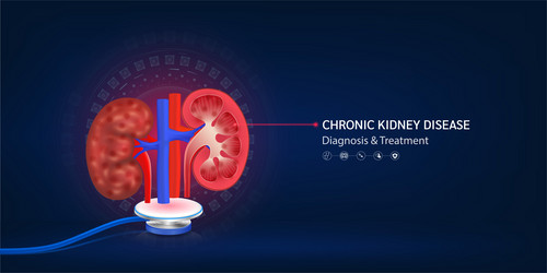 Chronic kidney disease human kidneys red Vector Image
