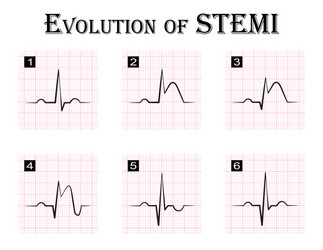Ecg sinusoidal pulse lines frequency heartbeat Vector Image