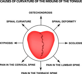 Erythema Vector Images (26)