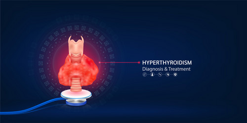 Hyperthyroidism disease human thyroid gland Vector Image