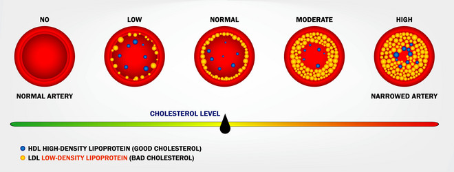 Hdl and ldl cholesterol cartoon good fat and bad Vector Image