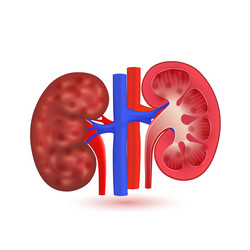 Chronic kidney disease human kidneys red model Vector Image