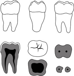 Tooth Pulp Vector Images (over 640)