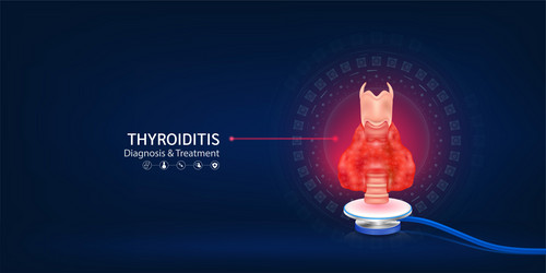 Hyperthyroidism disease human thyroid gland Vector Image