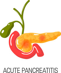 Acute pancreatitis close-up of a realistic Vector Image