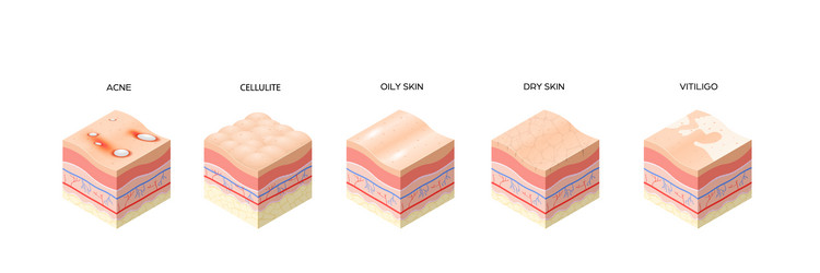 Skin Cross Section Vector Images (over 1,000)