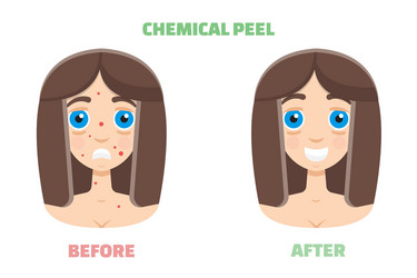 Cosmetic peeling chemical peeling before after Vector Image