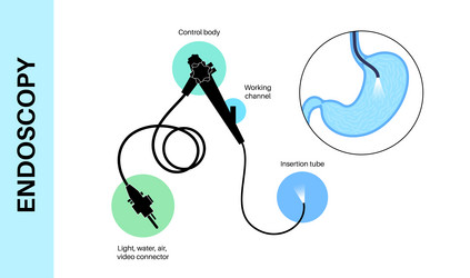 Gastroscopy endoscopy procedure Royalty Free Vector Image