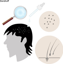 Dandruff isolated cartoon Royalty Free Vector Image