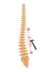 Spinal injury icon isolated Royalty Free Vector Image