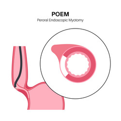 Poem medical poster Royalty Free Vector Image - VectorStock