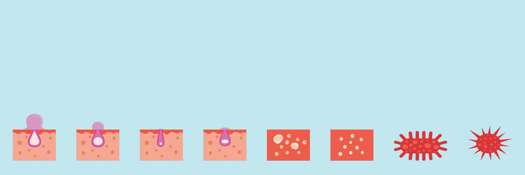 Acne Sebum Vector Images (over 200)