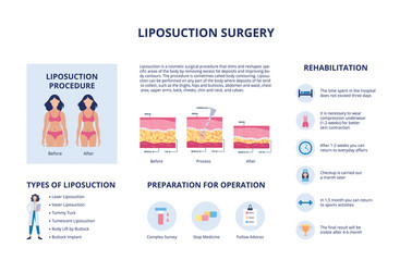 Liposuction Vector Images (over 2,800)