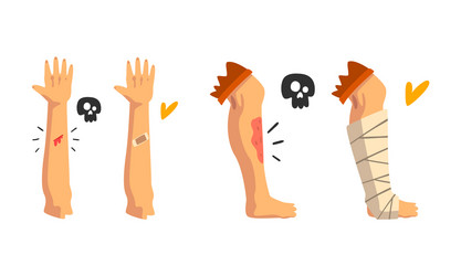 First aid for wounded leg and arm set Royalty Free Vector