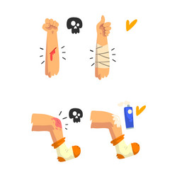 First aid for wounded leg and arm set Royalty Free Vector