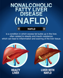 Nafld Vector Images (33)