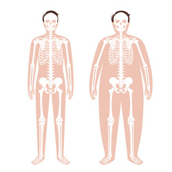 Obese skeleton anatomy Royalty Free Vector Image
