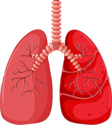 Diagram showing healthy and pneumonia lungs Vector Image