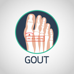 Gout arthritis infographic Royalty Free Vector Image