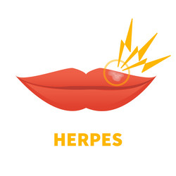 Herpes hsv cold sore lip outbreak medical icon Vector Image