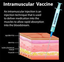 Information on intramuscular injection Royalty Free Vector