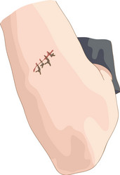 Scar Vector Images (over 6,900)