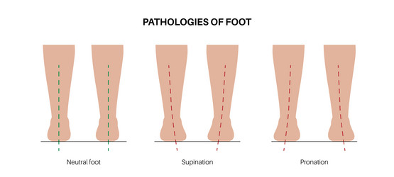 Pronation Vector Images (52)